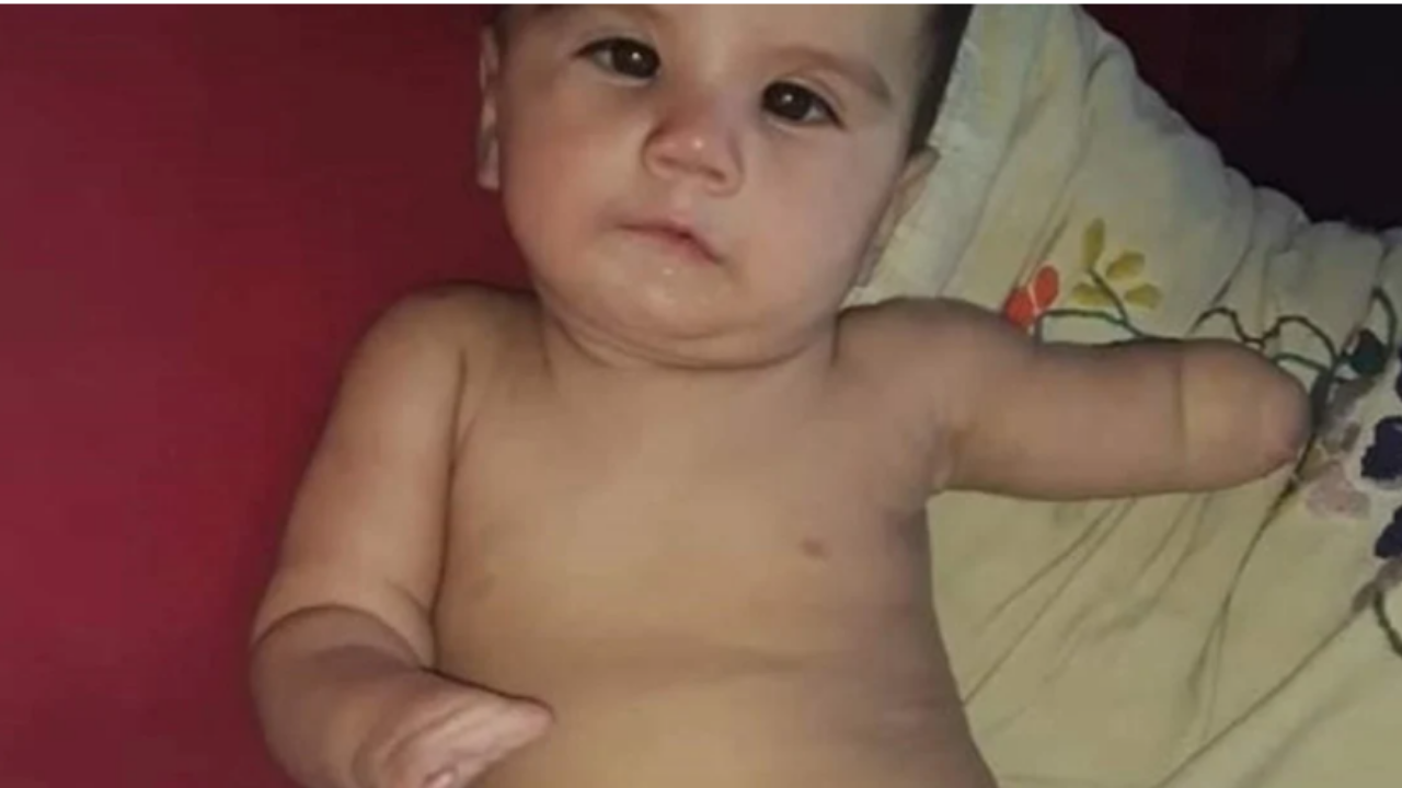 Un bebé de Lomas nació sin un brazo, una mano y una pierna y su familia ...